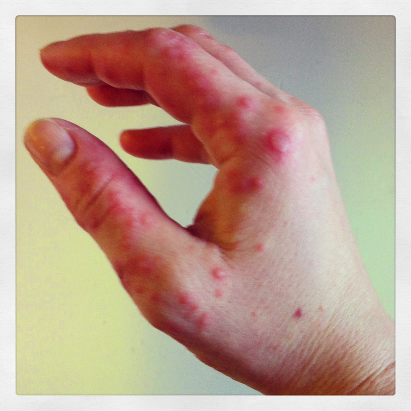 Tässä elämä on: Enterorokko osa 2