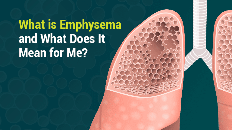 What Is Emphysema? - Teroes