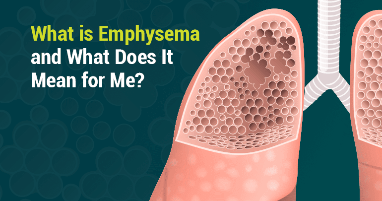 What Is Emphysema? - Teroes