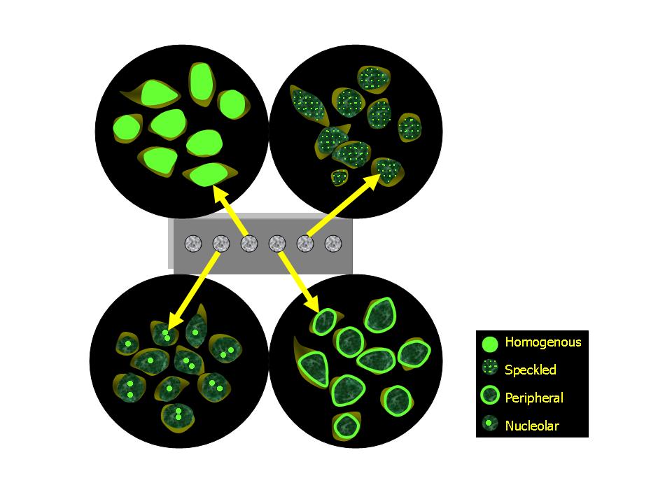 Lab Series #16: Anti Nuclear antibodies