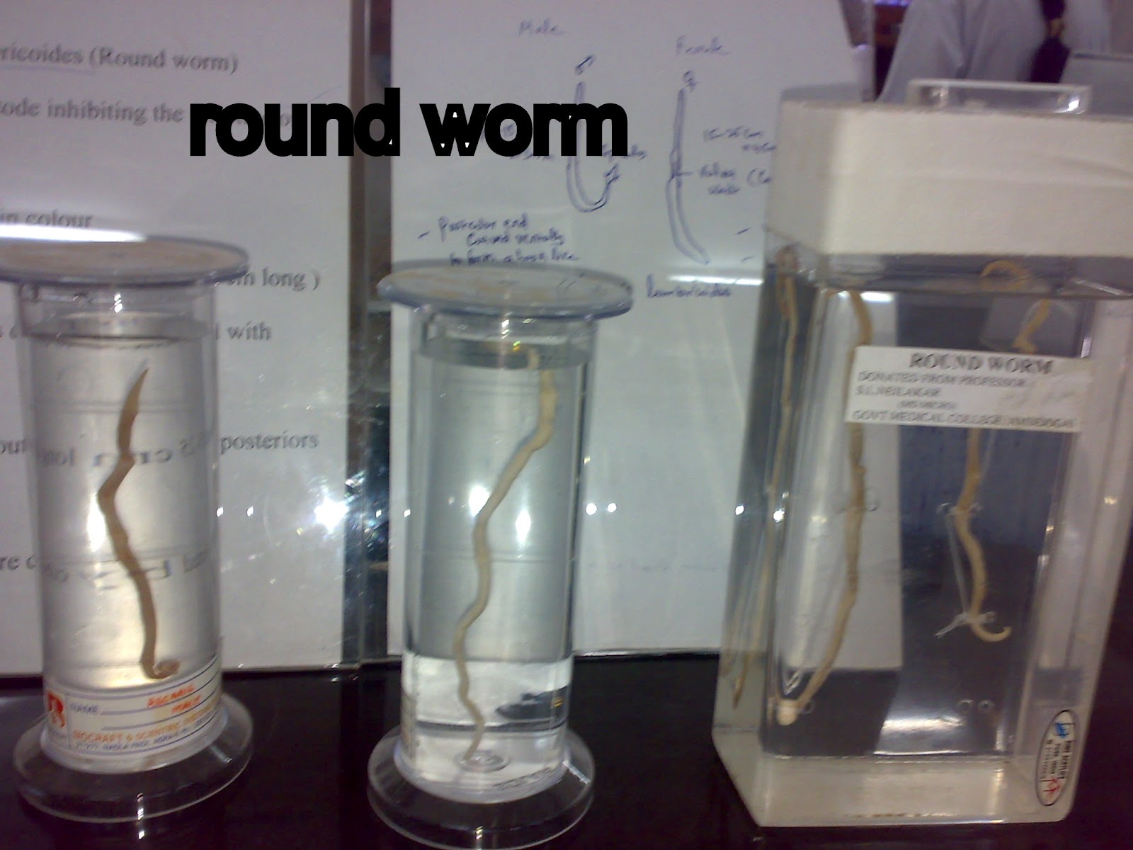 ROUND WORM - infects 1 in every 4 persons in world!!!!!! ~ MBBS circle
