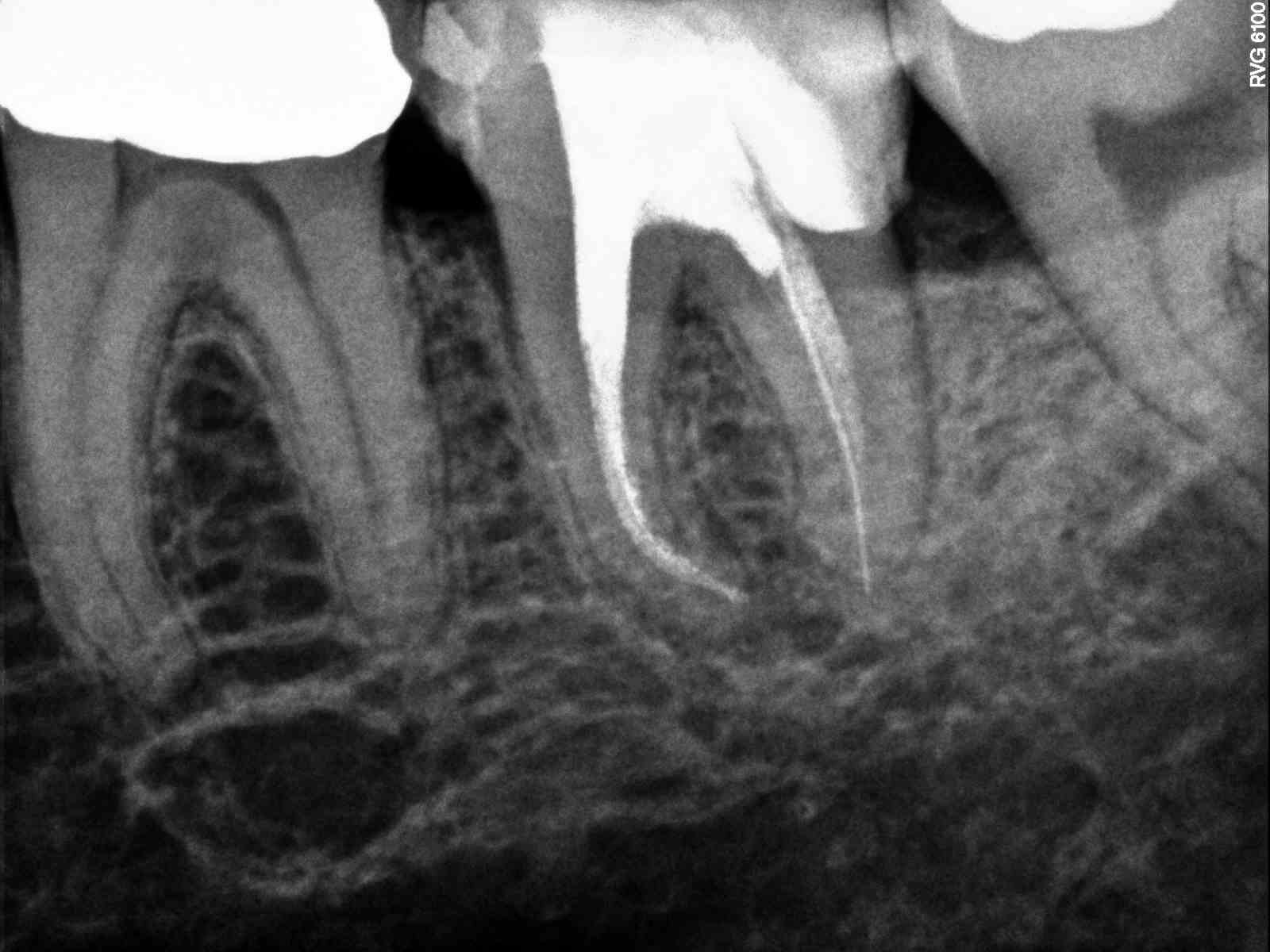 WM 51 - Bauer Smiles