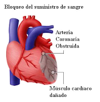 Enfermedades cardiovasculares