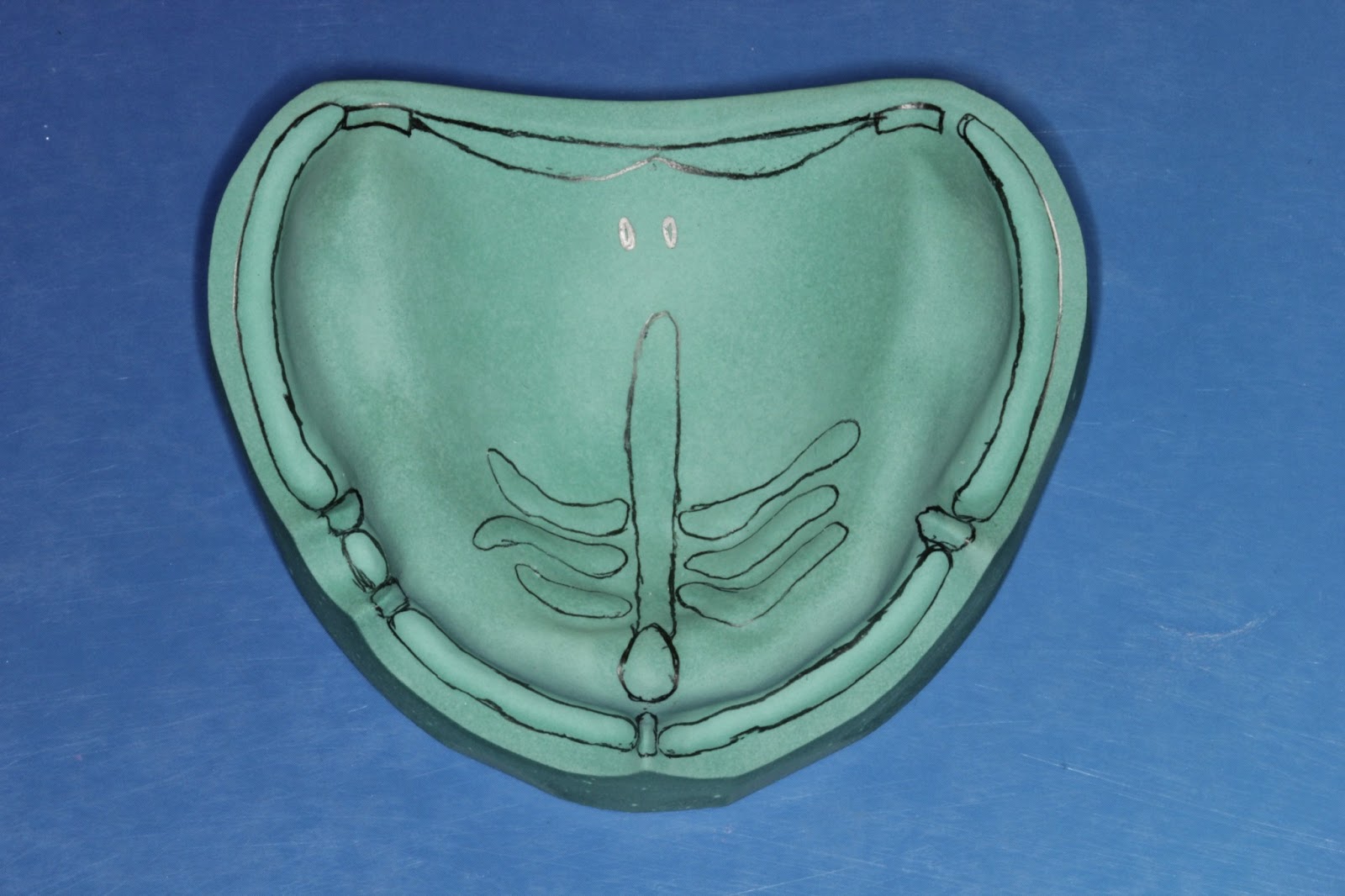 Understanding Prosthodontics - Tagore Dental College & Hospital-By ...