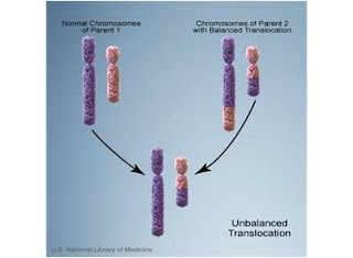 Olivia Rich Honors Biology : Cri du Chat Research