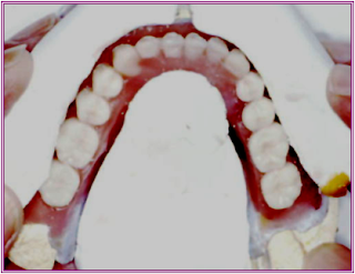 Dentistry and Medicine: Concept of Neutral Zone