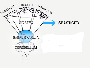 Physiotherapy: Cerebral Palsy and Physiotherapy.