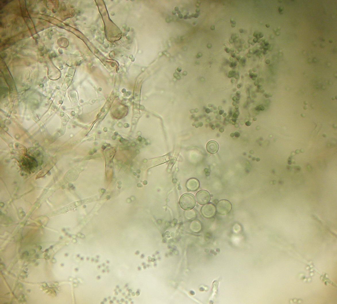 ATLAS MICOLOGIA: ASPERGILLUS NIDULANS