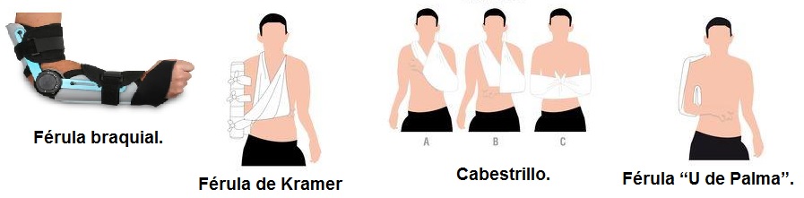 24 TES: Inmovilización del paciente.