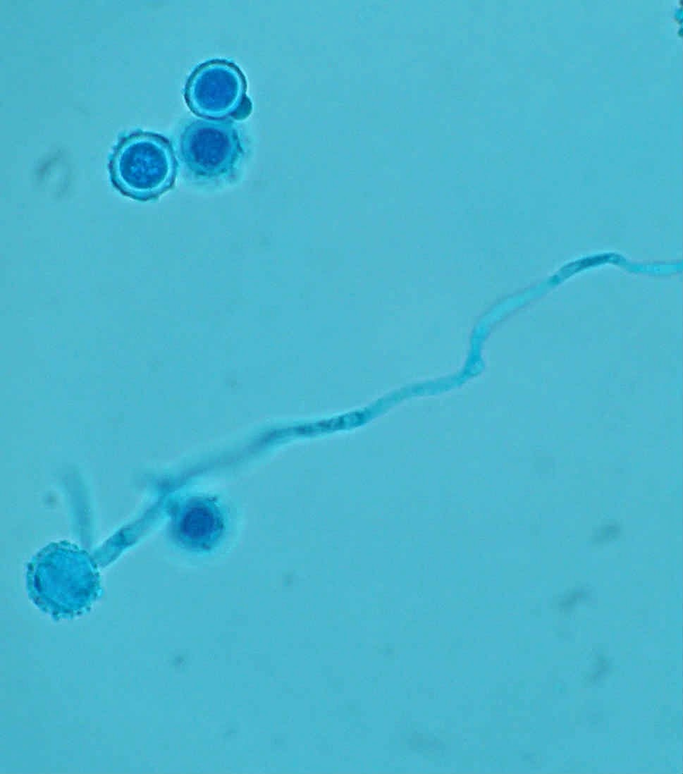 ATLAS MICOLOGIA: CONIDIOBOLUS CORONATUS