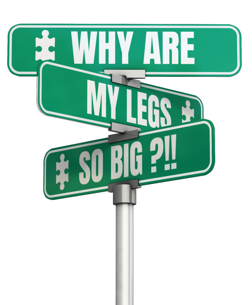 Lipidema Hogwarts: Rare Adipose Disorder is another name for Lipidema