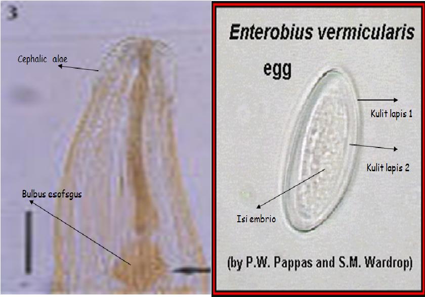 Oxyuris vermicularis ~ Examination and Happiness