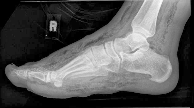 Tecnicos Radiologos: agosto 2015