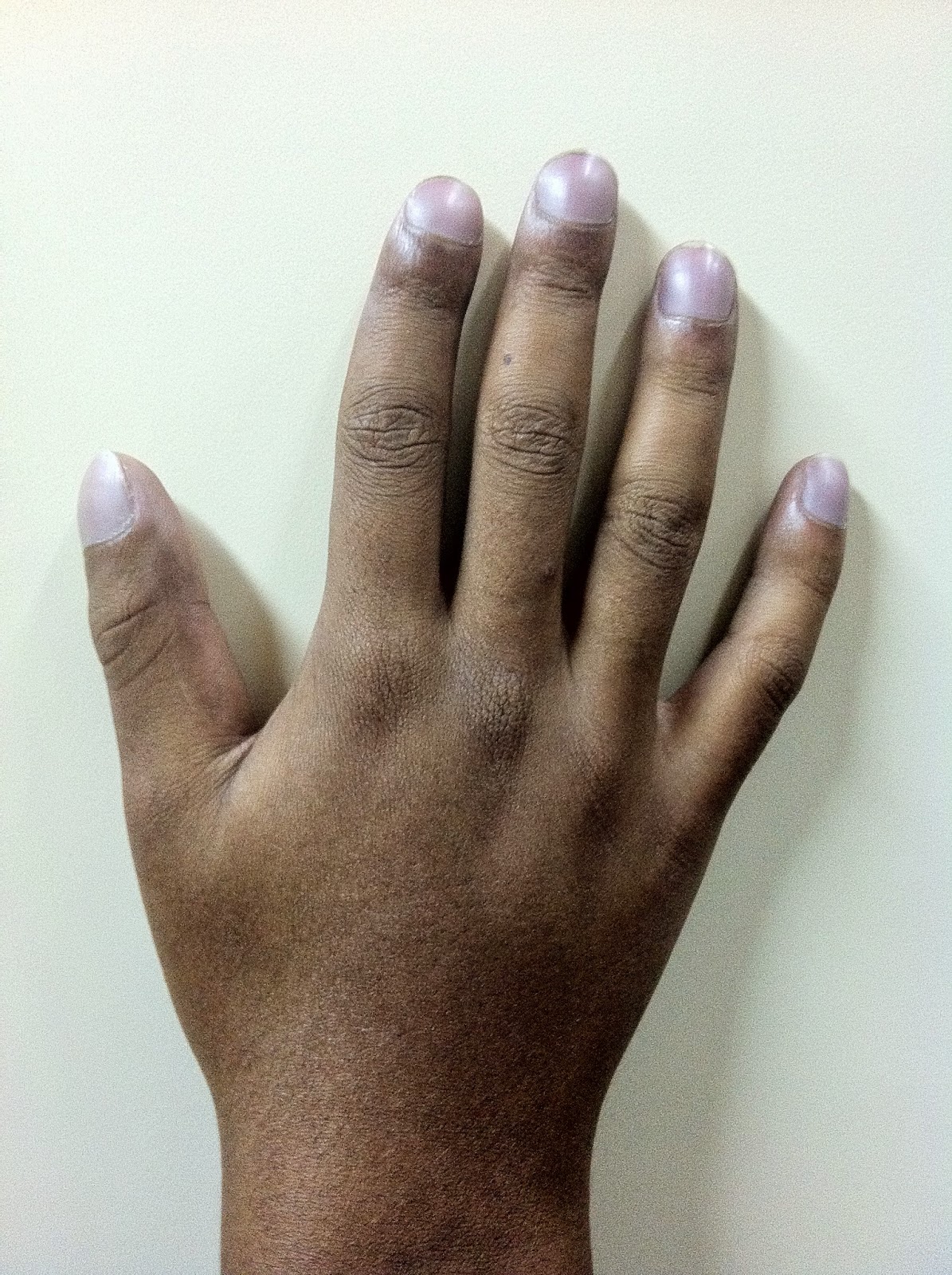 Discusión de Casos Clínicos : Respuestas de Imágen médica #1 ...