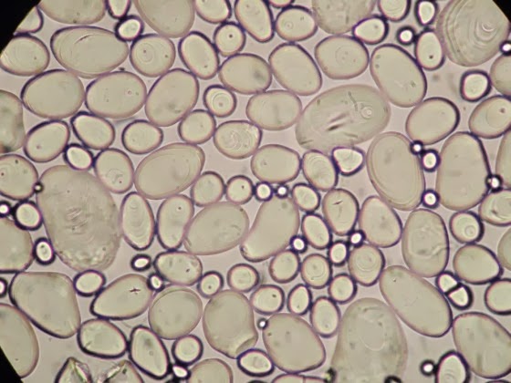 Mikroskopi Amylum ~ Welcome Directioners!!