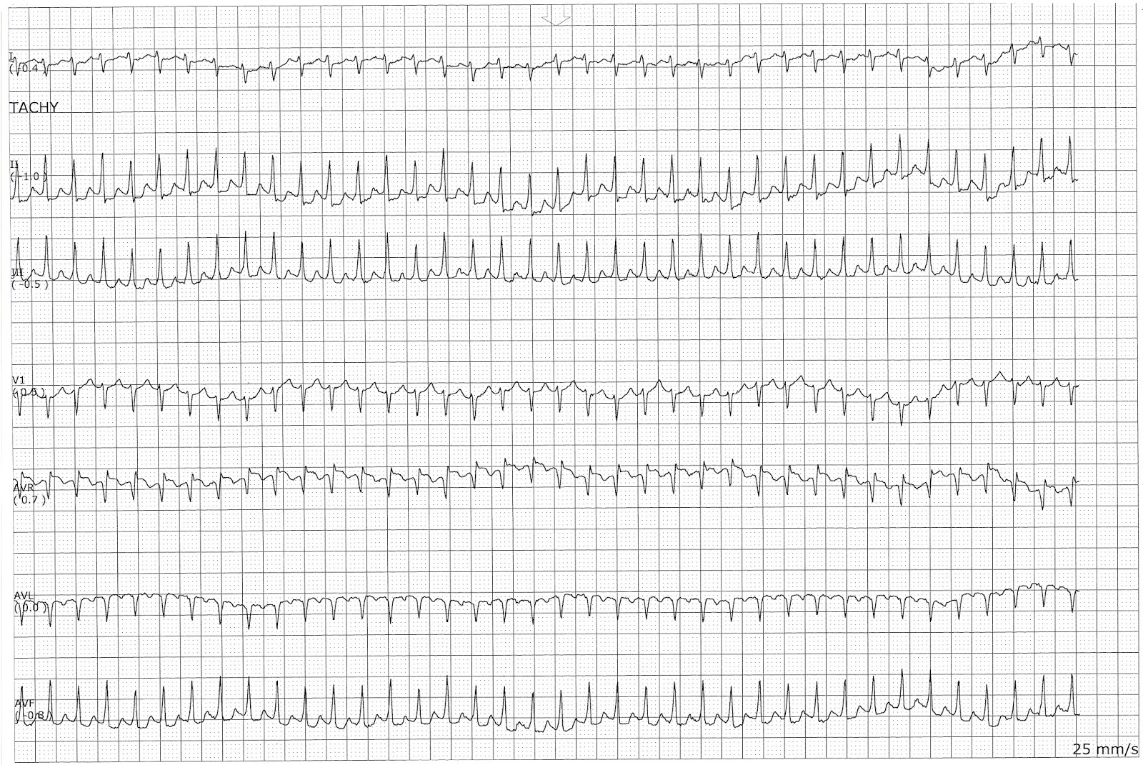 Float Nurse: October 2017