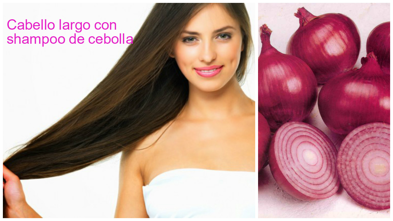 Shanpoo de cebolla para acelerar el crecimiento del cabello ~ lodijoella