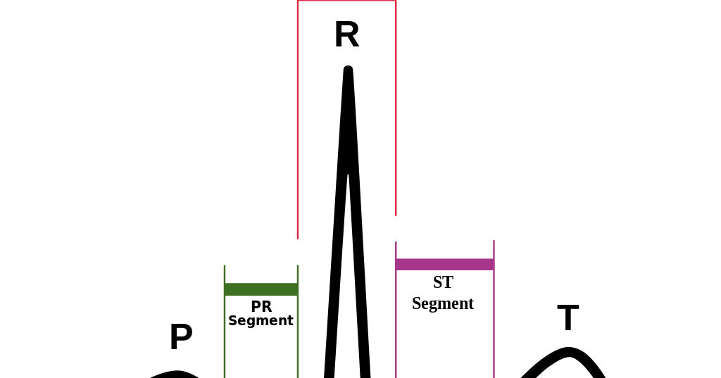 ECG Educator Blog : Basic Electrophysiology