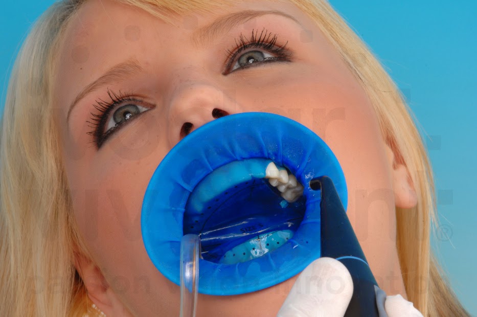 VERTIDENT: OPTRADAM AISLAMIENTO ABSOLUTO