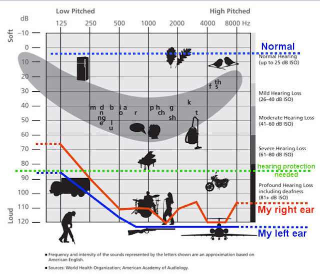 Ray's hearing journey: THE PSYCHOLOGY OF DEAFNESS - PART TWO