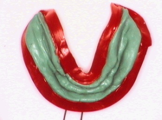 Dentistry and Medicine: Elastic Impression Materials-Elastomers ...