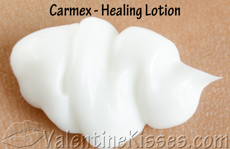 Valentine Kisses: Carmex – Healing Lotion, Healing Cream