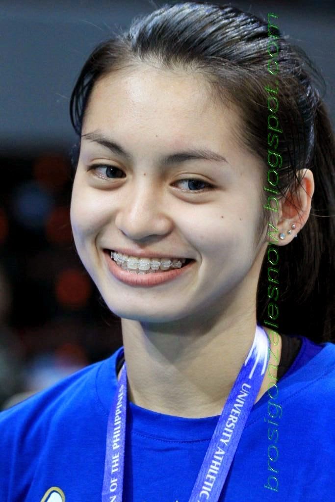 Denden Lazaro Eyes