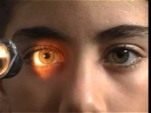 Signos vitales: REFLEJO PUPILAR