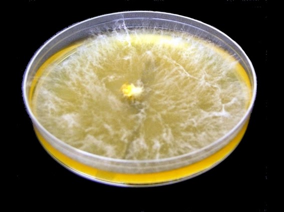 Fun With Microbiology (What's Buggin' You?): August 2014