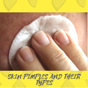 SKIN-PIMPLES-AND-THEIR-TYPES - Skin Care - Always Health