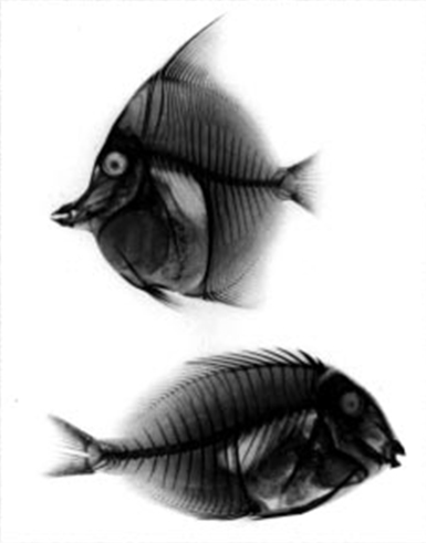 Hyder Ismail: A short History of X-rays