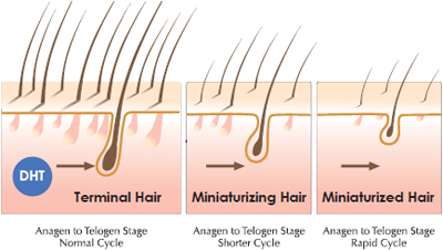 BioMedic’s Hair Loss Solutions