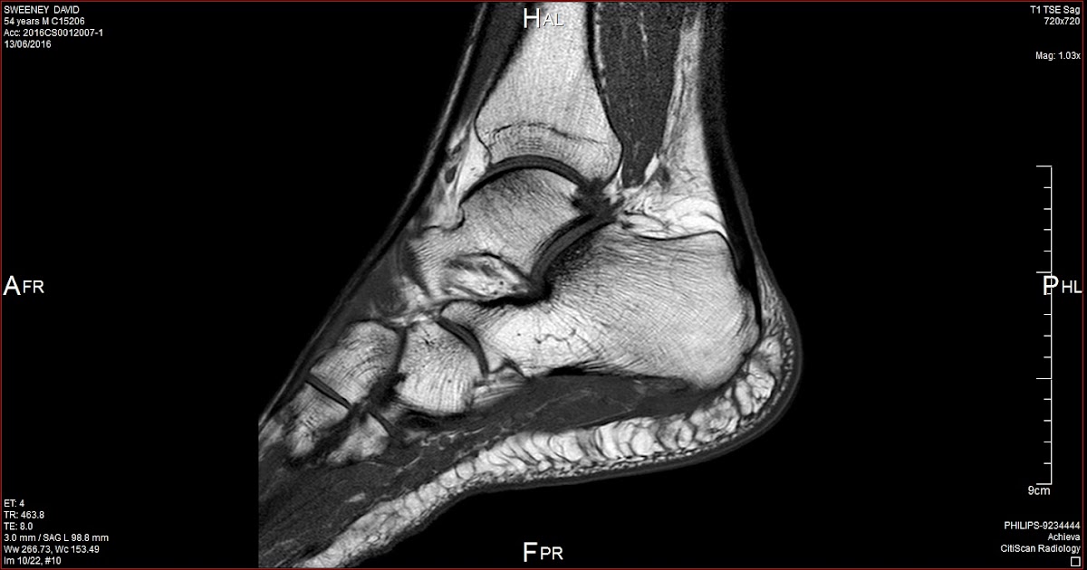 running masters: MRI