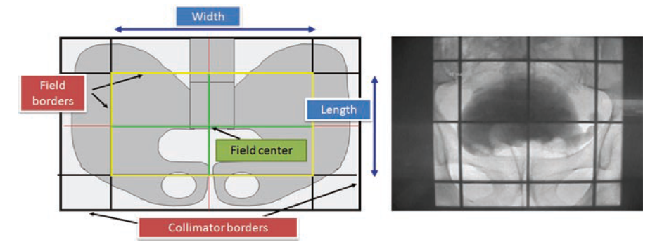 Computed Tomography: Conventional vs CT-SIM