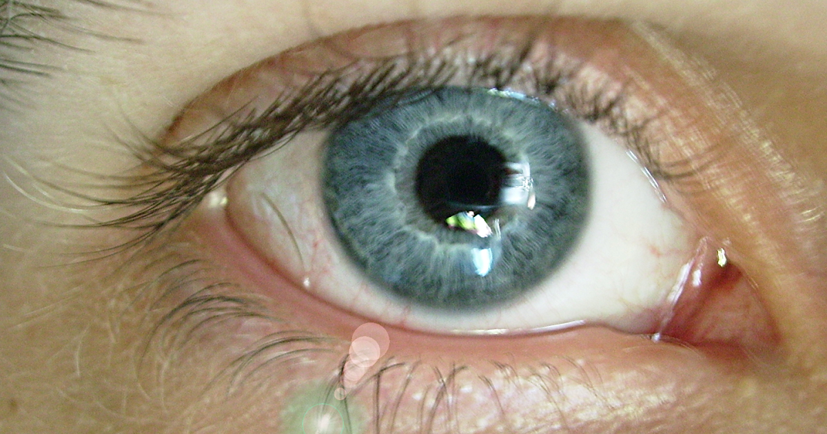 Boererate.com: Astigmatisme