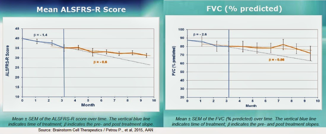BCLI: Five Conclusions From Brainstorm's ALS Poster at AAN