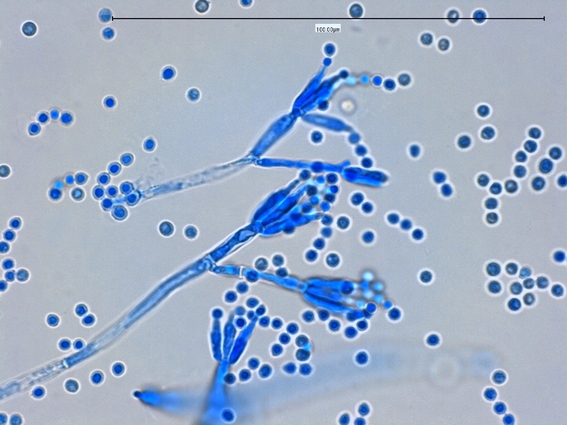 Fun With Microbiology (What's Buggin' You?): Penicillium citrinum