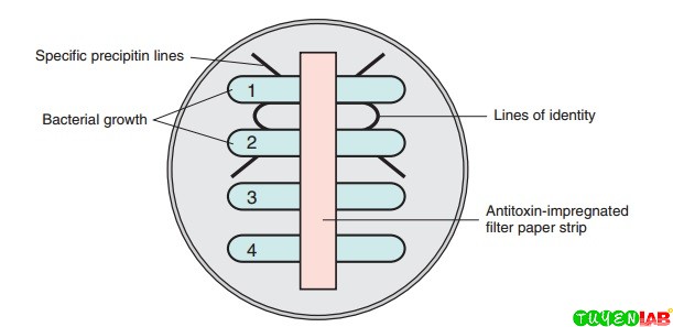 [Microbiology] Atlas of Aerobic Gram-Positive Bacilli | Free Medical Atlas