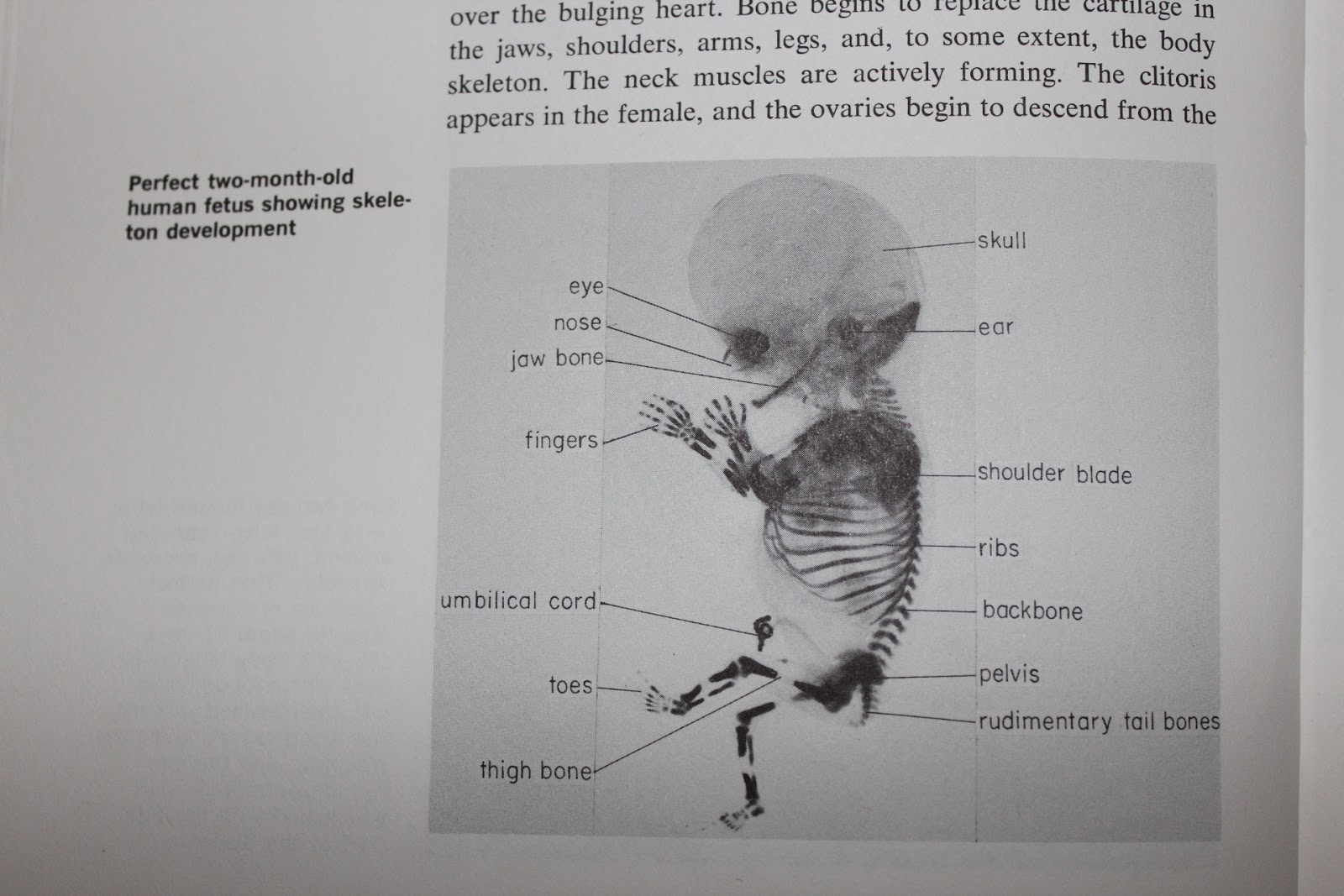 Real Women Have Babies : Medical photos of baby in womb w/ developed ...
