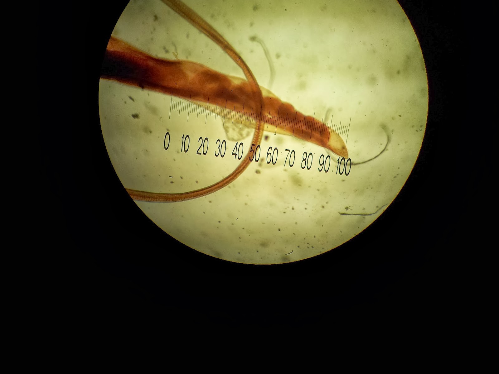 Atlas parasitología biologia sanitaria: Trichuris trichiura