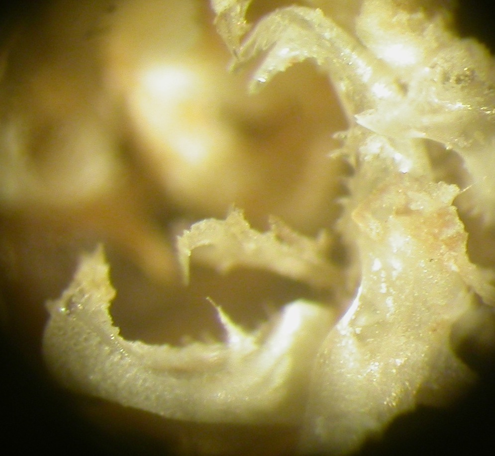 The Echinoblog: The Panoply of Pedicellariae Post!