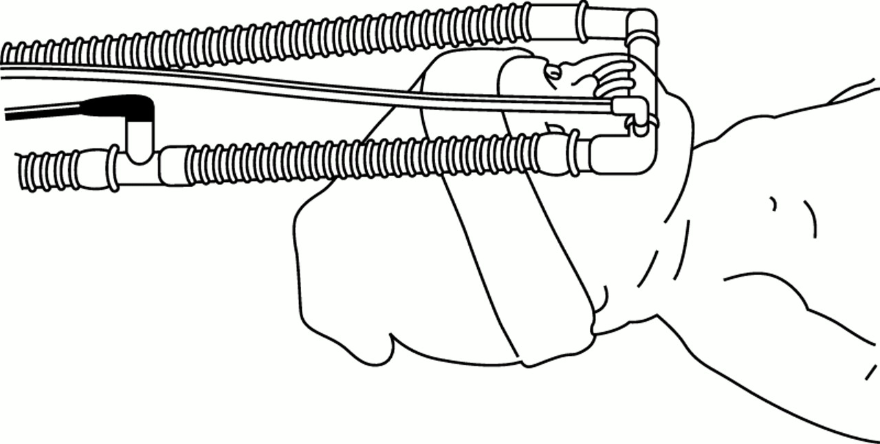 The Right Place To Get Health Reverences: Cannula Binasal