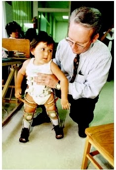 Sensory care Paediatric Services: So your baby has Spina Bifida