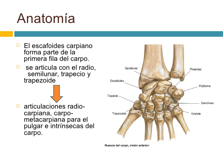 FMC BORMUJOS: FRACTURA DE ESCAFOIDES