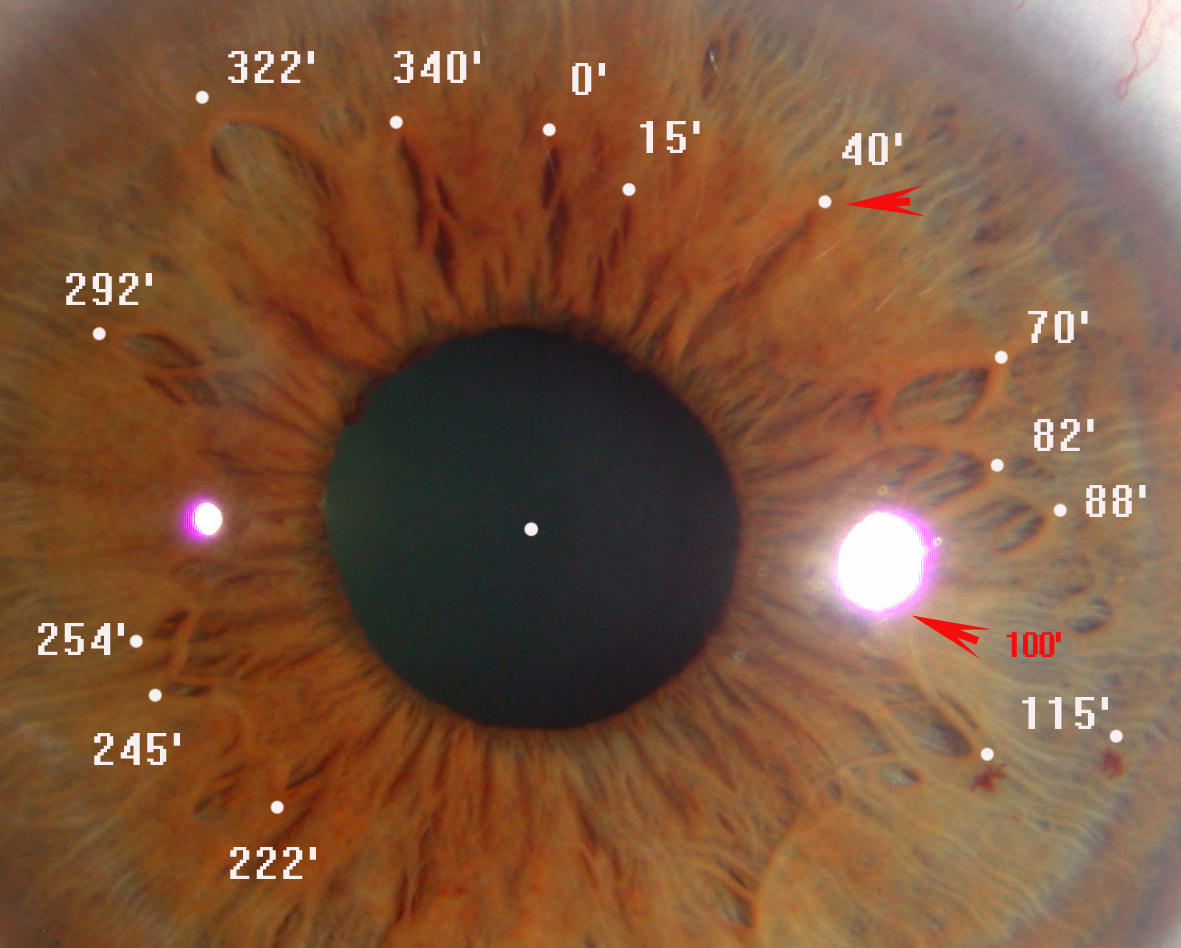Modern & Multidimensional Iridology: The Multidimensional Approach of ...