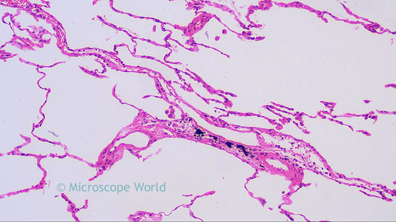Microscope World Blog: Human Lungs under the Microscope
