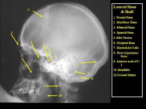 Dentistry and Medicine: Head and Neck Radiology-How to Identify ...
