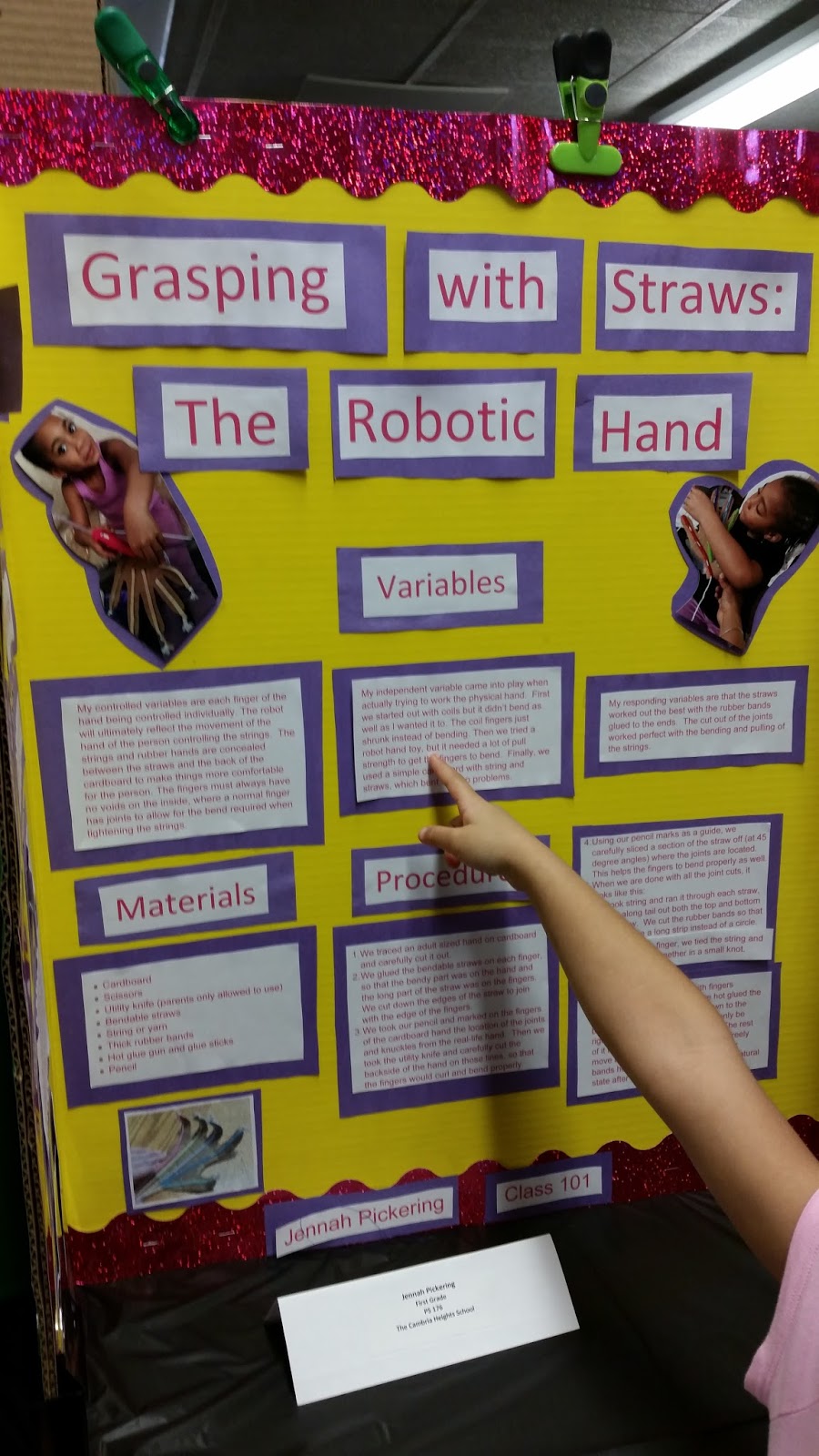 Prosthetic Hand Science Project