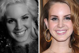 Lana Del Rey Plastic Surgery Before and After Lips Augmentation ...