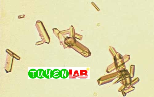 Atlas of Crystals found in alkaline urine | Free Medical Atlas